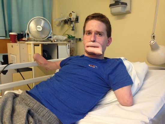 Alex Lewis Recovering Hospital Editorial Stock Photo Stock Image