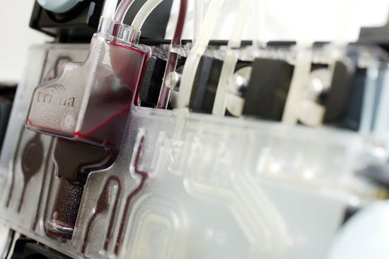 Trima Accel Automated Blood Collection System Editorial Stock Photo ...