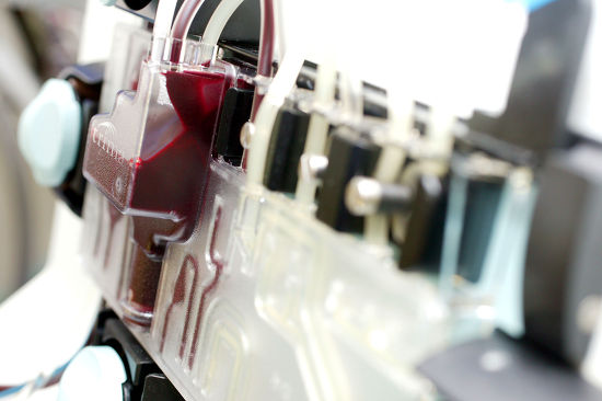 Trima Accel Automated Blood Collection System - Foto de stock de ...