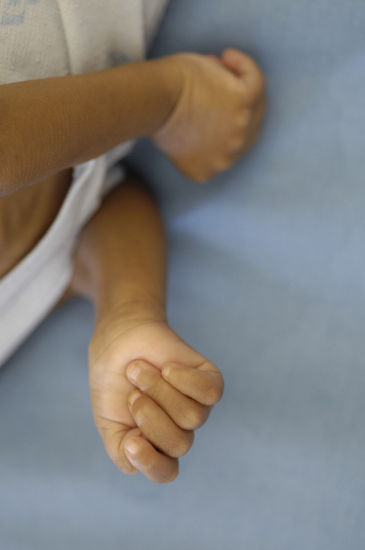 Model Released Cerebral Palsy Disorder Movement Editorial Stock Photo ...