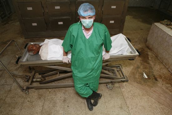 Pathologist Stands Over Corpse Mortuary Editorial Stock Photo - Stock ...