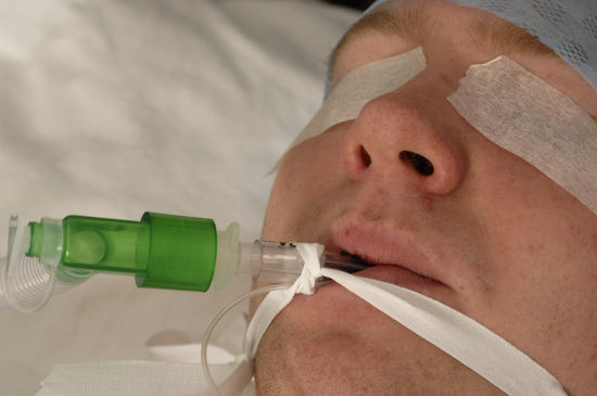 Close Anaesthetised Patient Editorial Stock Photo - Stock Image ...