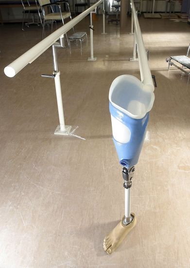 Above Knee Prosthesis Exercise Hand Rails Editorial Stock Photo - Stock ...