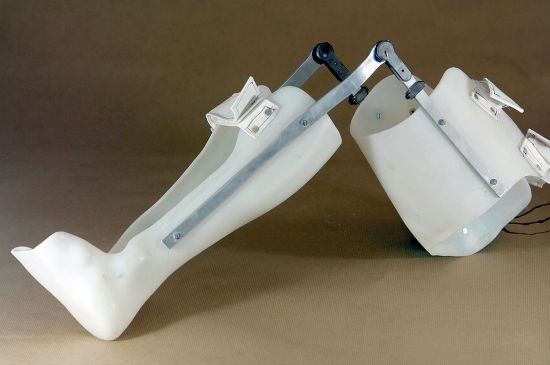 Caliper Knee Ankle Foot Orthosis Kafo Editorial Stock Photo - Stock ...