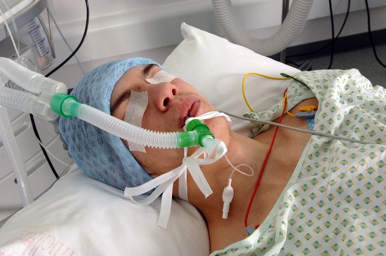 Close Anaesthetised Male Patient Tubes Mouth Editorial Stock Photo ...