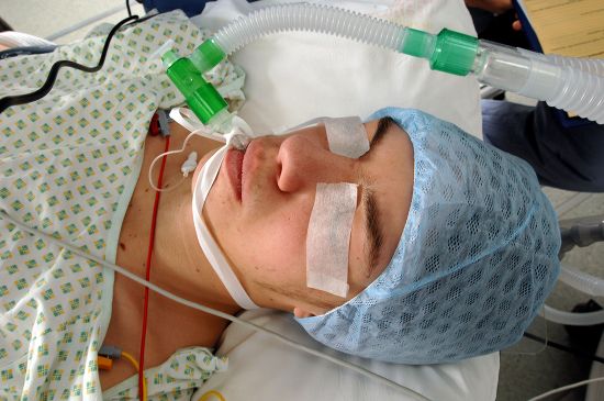 Close Anaesthetised Male Patient Tubes Mouth Editorial Stock Photo ...