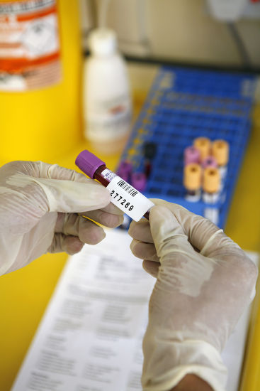 Pathologist Labels Blood Samples Test Tube Editorial Stock Photo ...