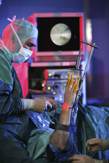 Arthroscopic Surgery Wrist Surgeon Sees Joint Editorial Stock Photo ...