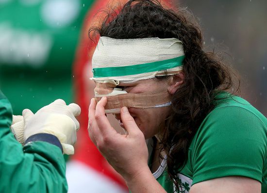 Irelands Paula Fitzpatrick Editorial Stock Photo - Stock Image ...