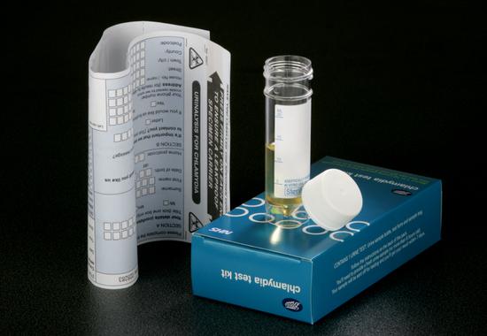 New Chlamydia Testing Kit Available Inner Editorial Stock Photo - Stock ...