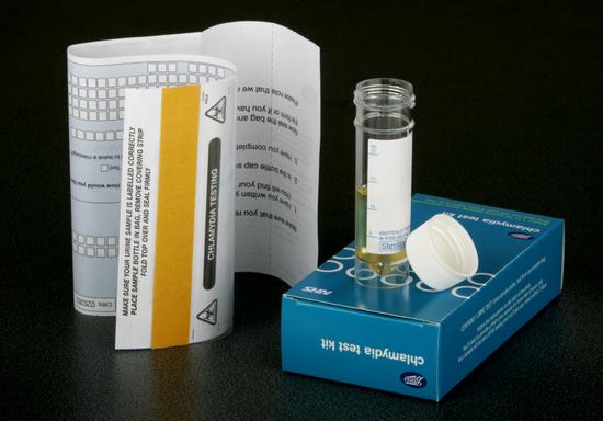 New Chlamydia Testing Kit Available Inner Editorial Stock Photo - Stock ...
