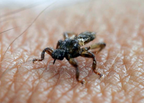 Elk Fly Lipoptena Cervi On Human Editorial Stock Photo - Stock Image ...
