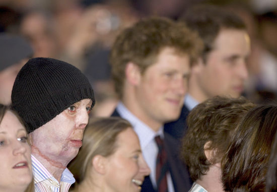 Lance Corporal Martyn Compton Prince Harry Editorial Stock Photo ...
