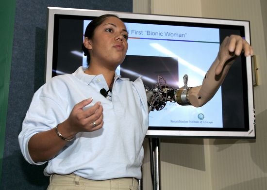 Amputee Claudia Mitchell First Woman Receive Editorial Stock Photo ...