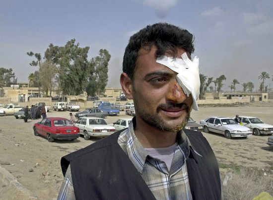 Iraqi Mohammed Hussein Leaves Fallujah Hospital Editorial Stock Photo ...