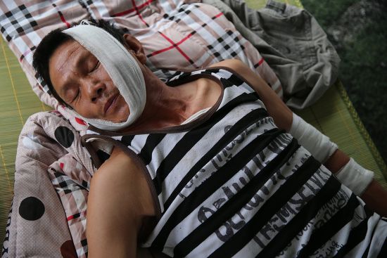 Displaced Injured Man Who Left Homeless Editorial Stock Photo - Stock ...