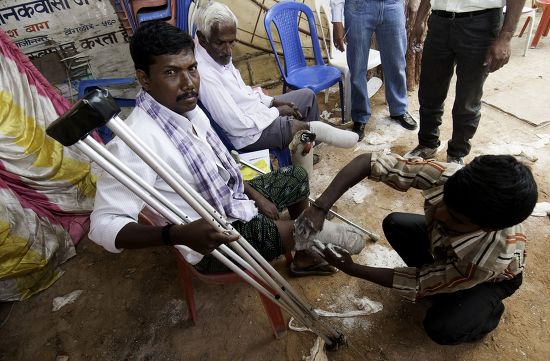 Indian Physically Challenged Receives Artificial Limb Editorial Stock ...