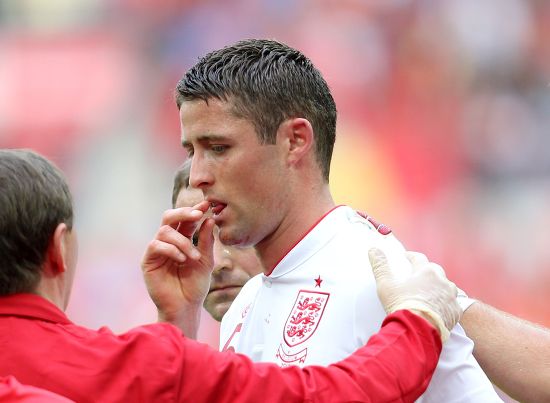 Gary Cahill England Checked Over Before Editorial Stock Photo - Stock ...