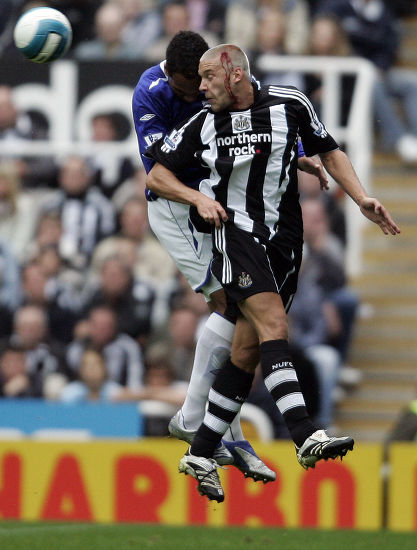 Alan Smith Newcastle United Blood Injury Editorial Stock Photo - Stock ...