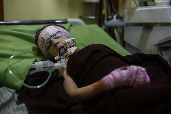 Injured Child Identified Yousef Receives Medical Editorial Stock Photo ...