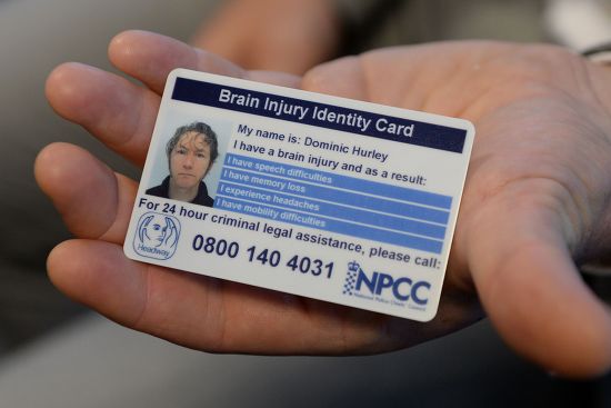 Brain Injury Survivor Dominic Hurley Holds Editorial Stock Photo ...