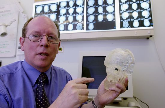 Cranio Facial Surgeon David Dunaway Great Editorial Stock Photo - Stock ...