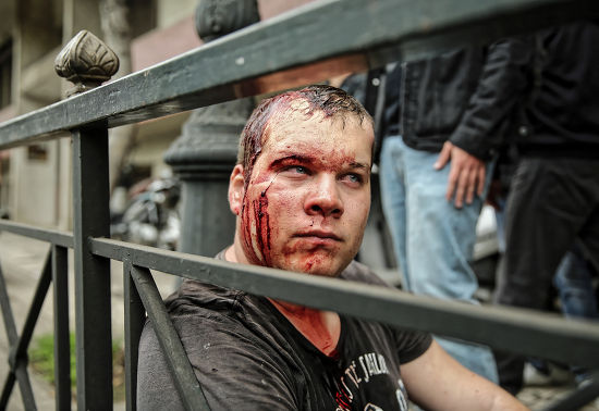 Protester Bloodied Head Rests On Pavement Editorial Stock Photo - Stock ...