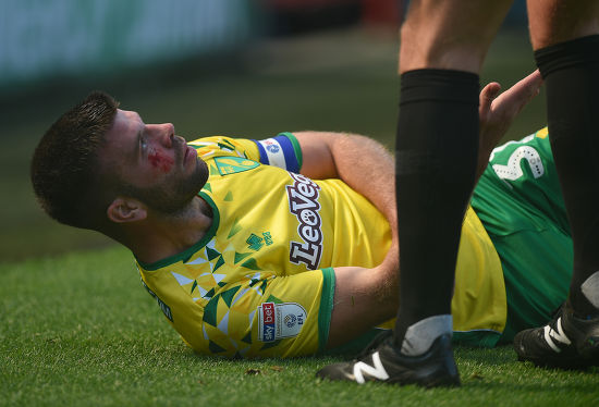 Detail Cut Under Eye Grant Hanley Editorial Stock Photo - Stock Image ...