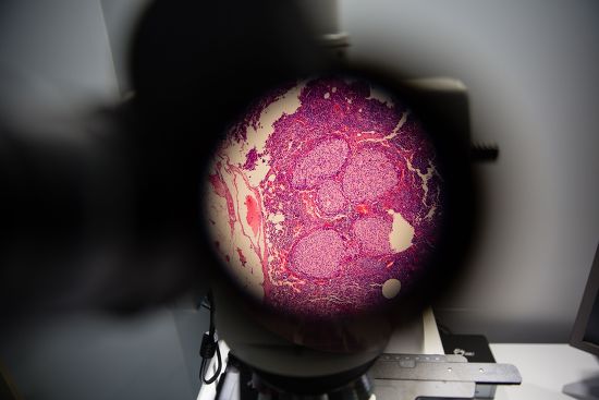 View Through Augmented Reality Microscope That Editorial Stock Photo ...