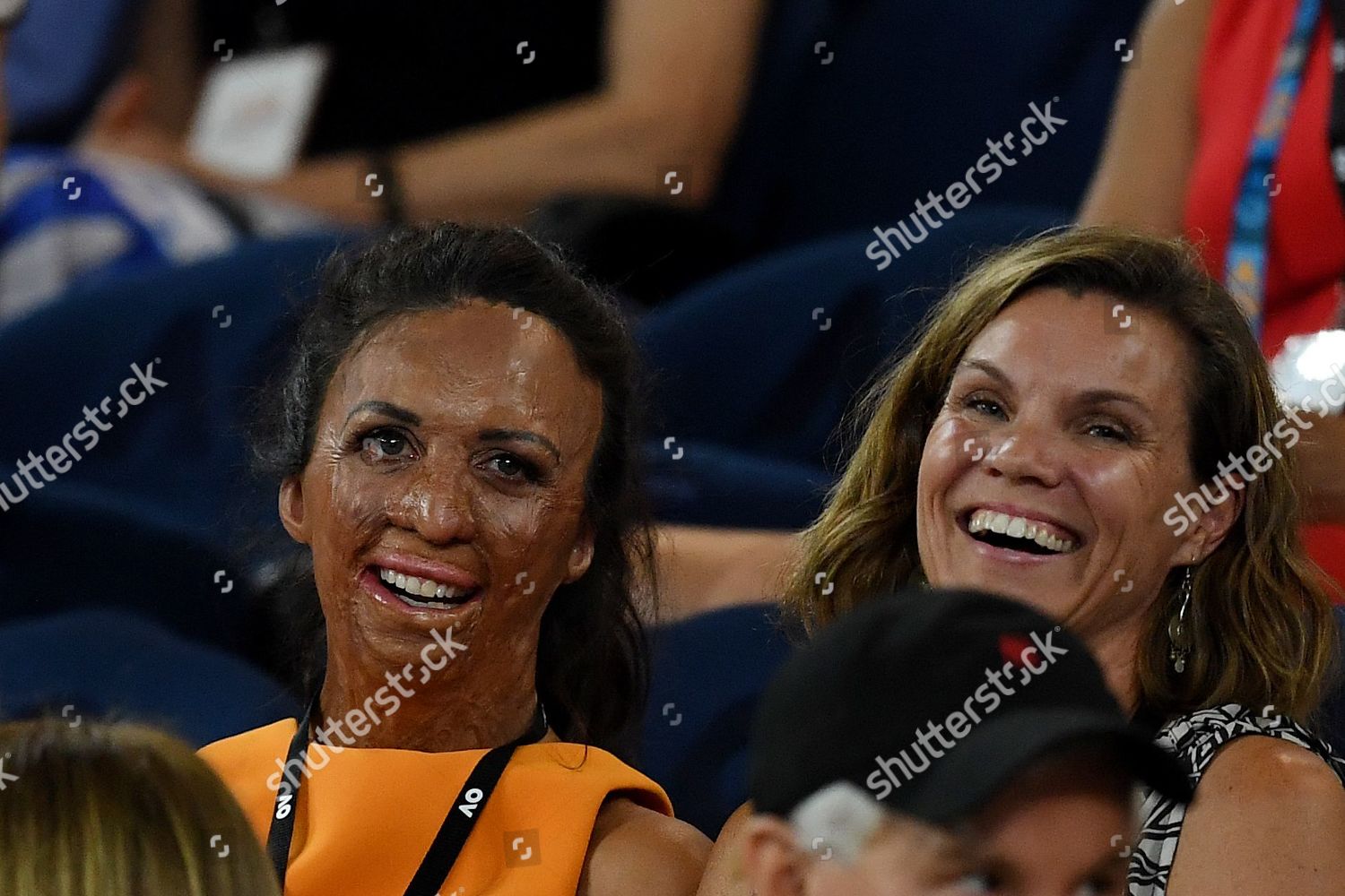 Australian Personality Turia Pitt L Seen Editorial Stock Photo - Stock ...