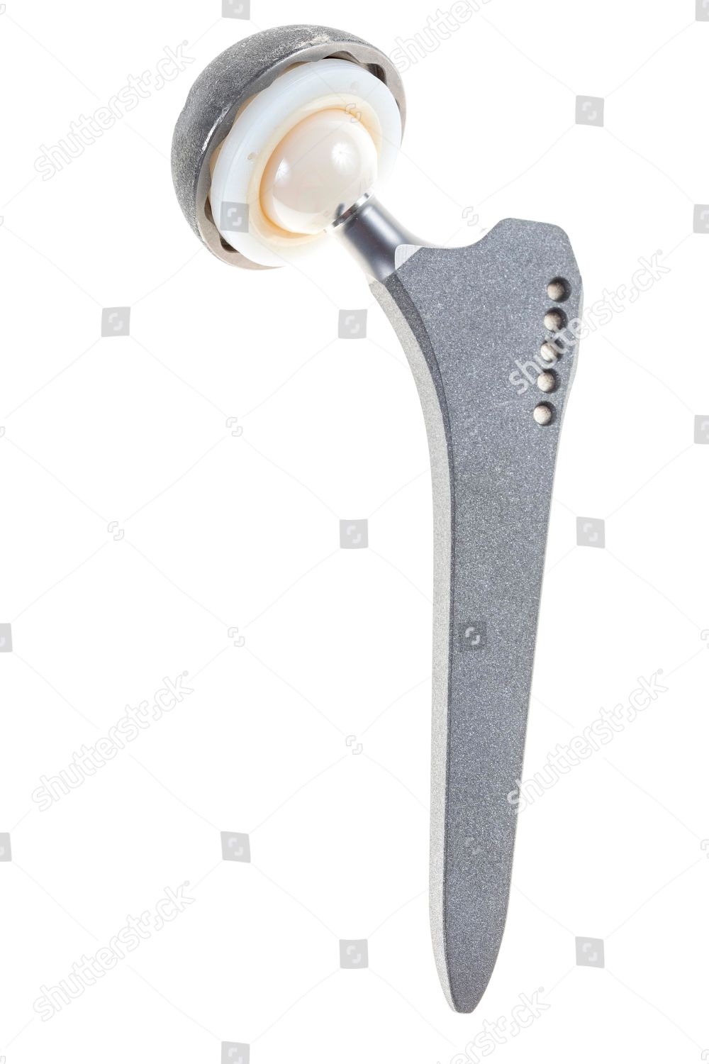 Endoprosthesis Artificial Hip Joint Consisting Hip Editorial Stock ...