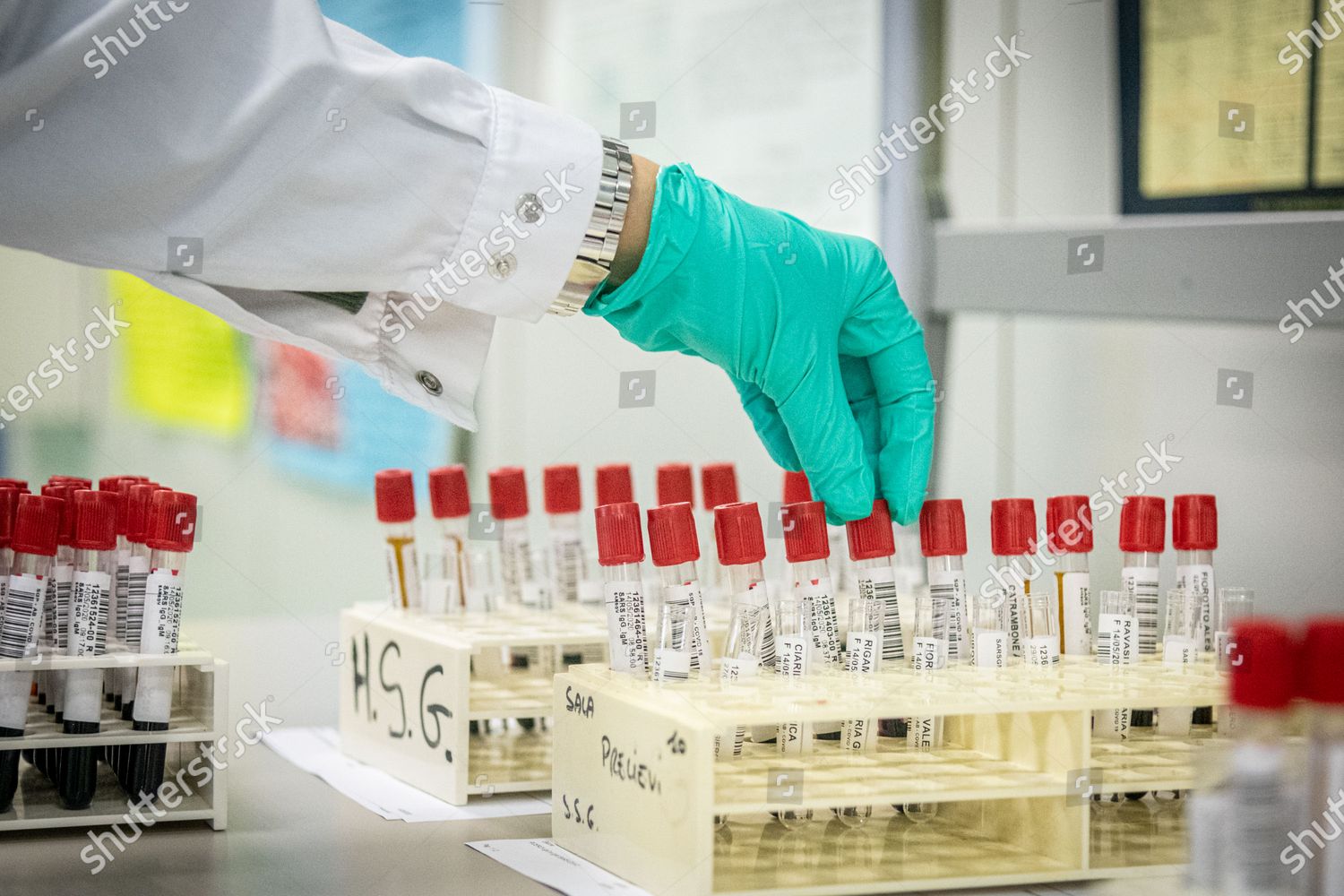 Covid19 Serological Tests Individuals Microbiology Virology Editorial ...
