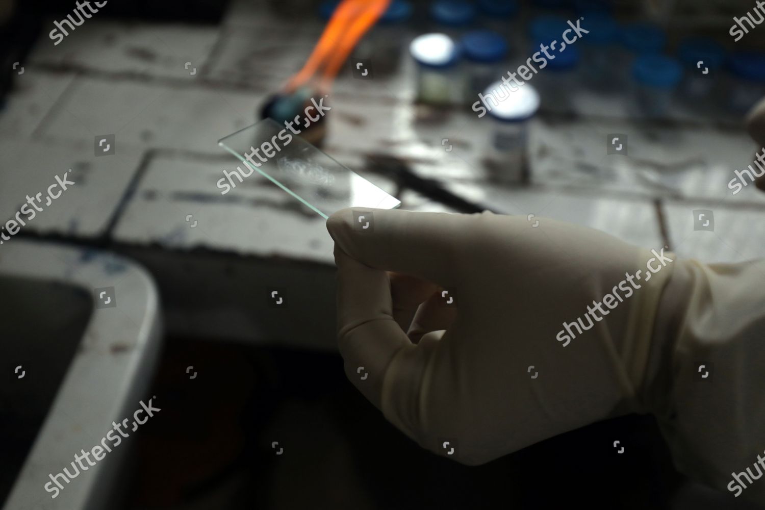 Sample Tb Tests Being Processed Designated Editorial Stock Photo ...