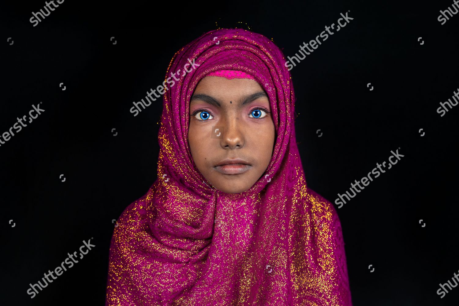 Tasnim Family Members Unusual Pigmentation Show Editorial Stock Photo ...