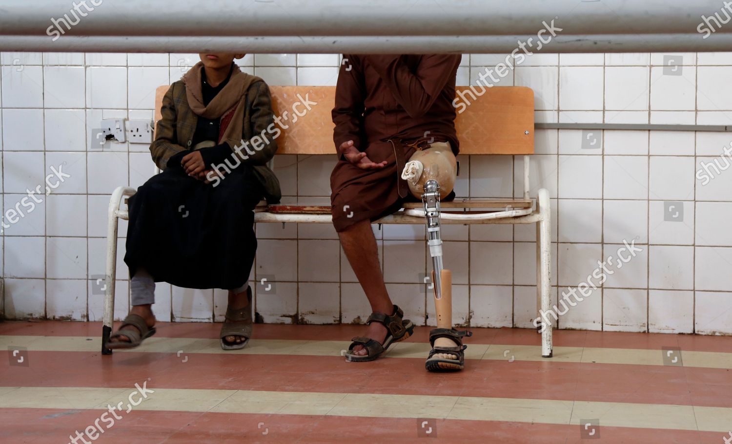 Man Who Lost His Left Leg Editorial Stock Photo - Stock Image ...