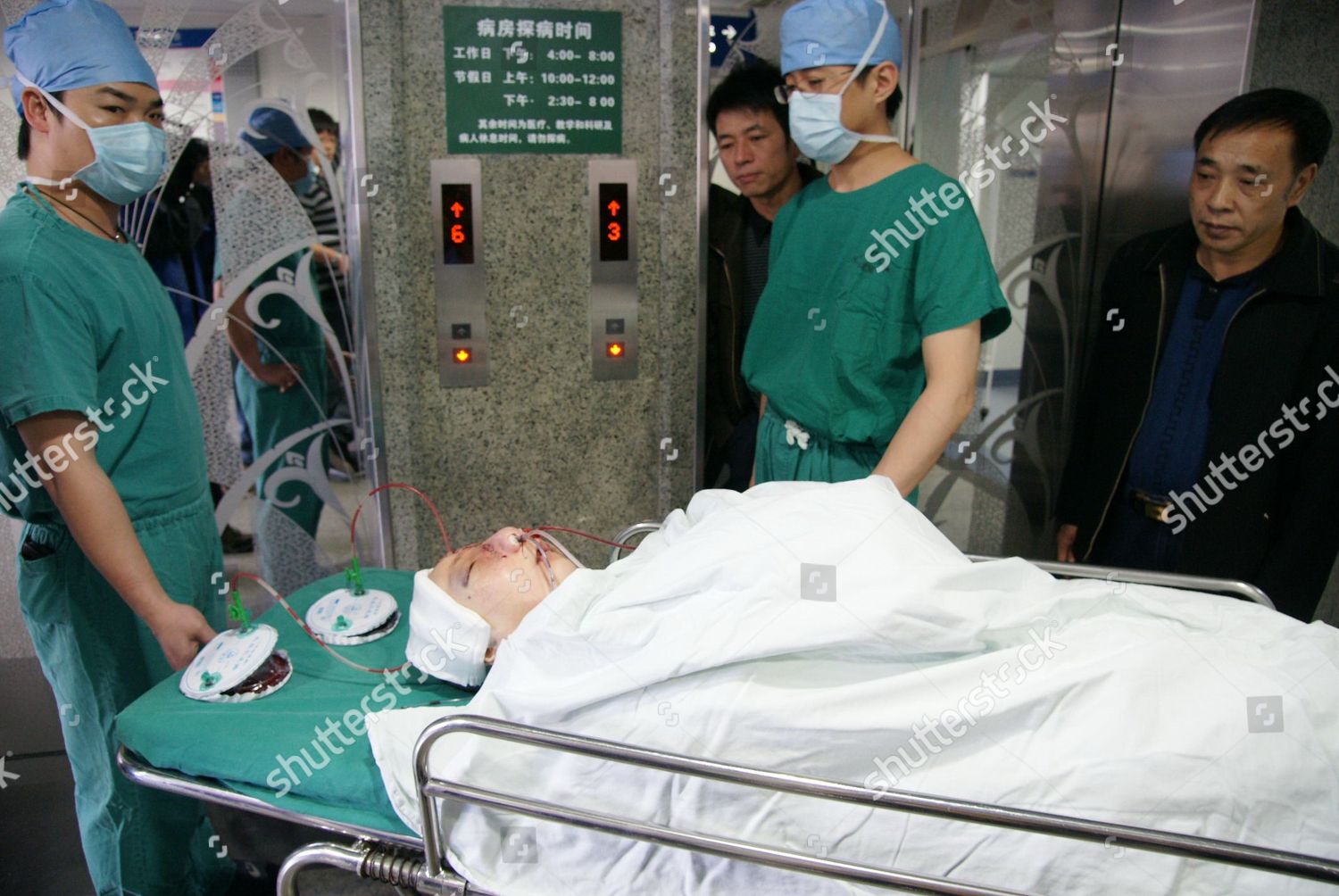 WU XIAOYAN WHEELED OUT OPERATING THEATRE Editorial Stock Photo - Stock Image | Shutterstock