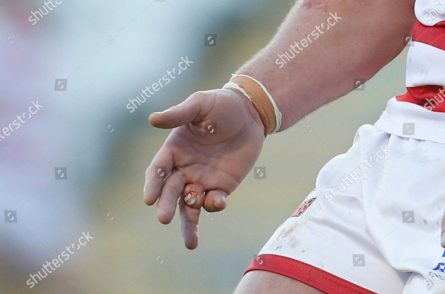Leigh Centurions Nathan Mason After Sustaining Editorial Stock Photo ...