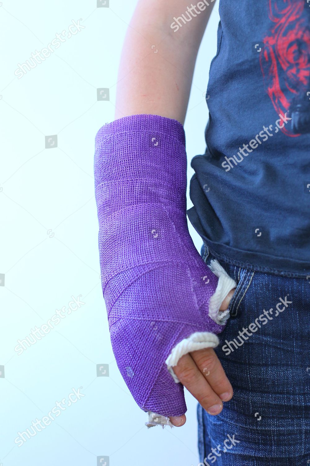 Boy His Arm Plaster Cast Editorial Stock Photo - Stock Image | Shutterstock