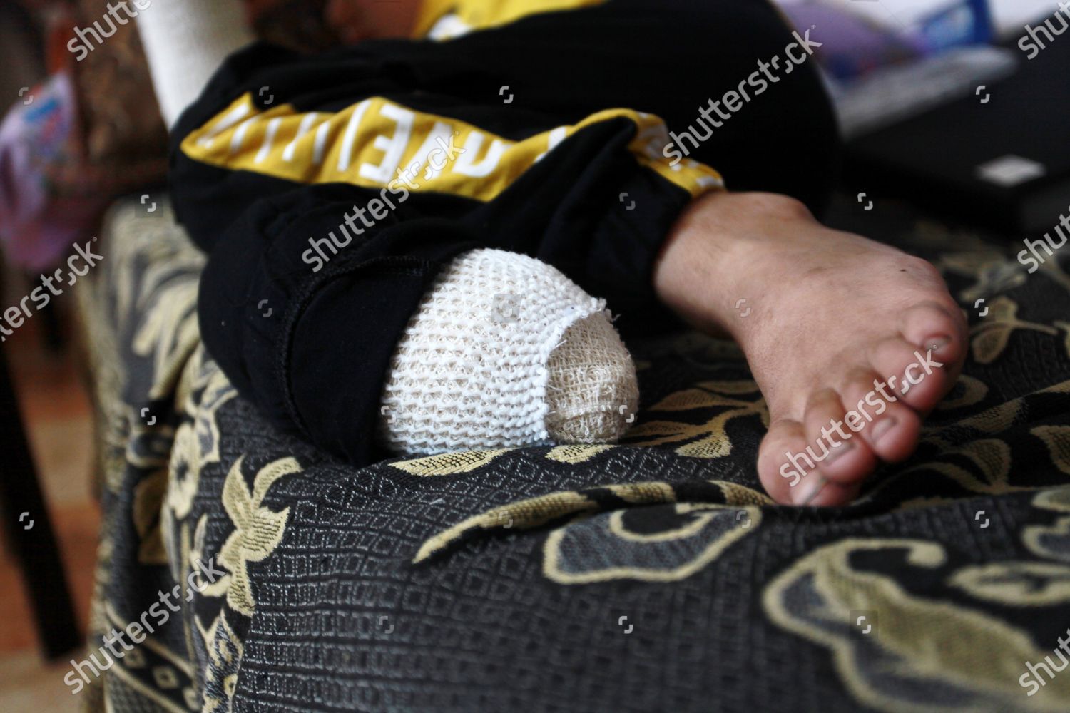 Palestinian Child Saleh Hamid 7 Whose Editorial Stock Photo - Stock ...