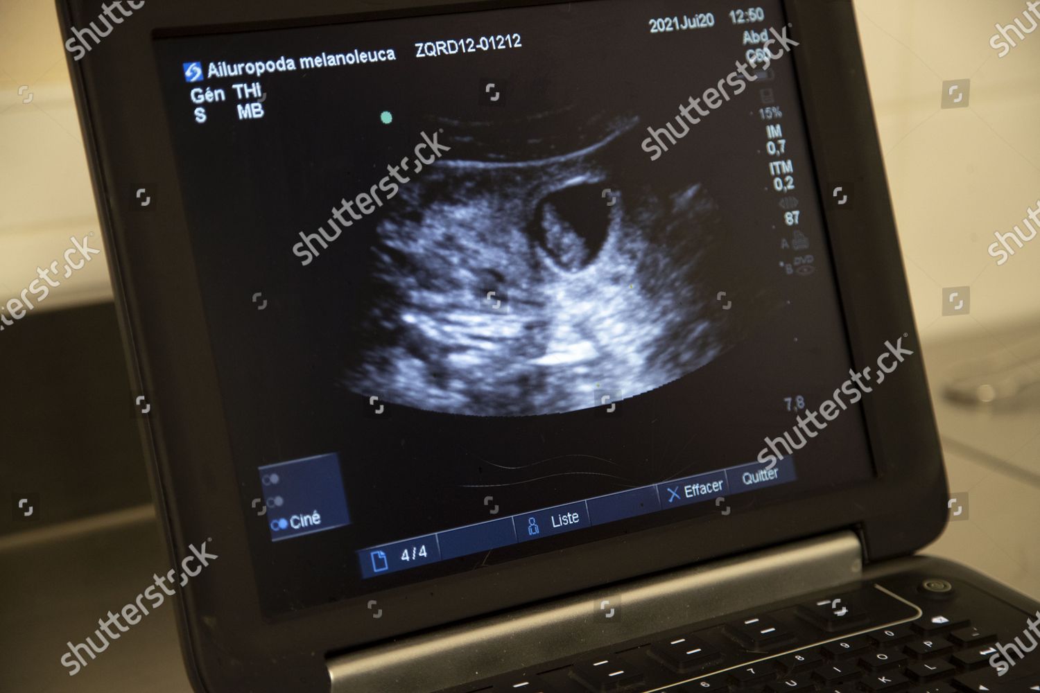 Embryo Giant Panda Huan Huan Detected Editorial Stock Photo - Stock ...