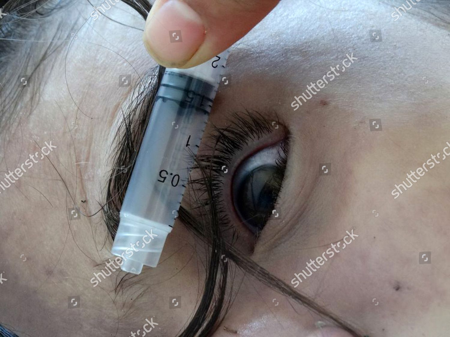 Pupil Dead Child Dilated After Alleged Editorial Stock Photo - Stock ...