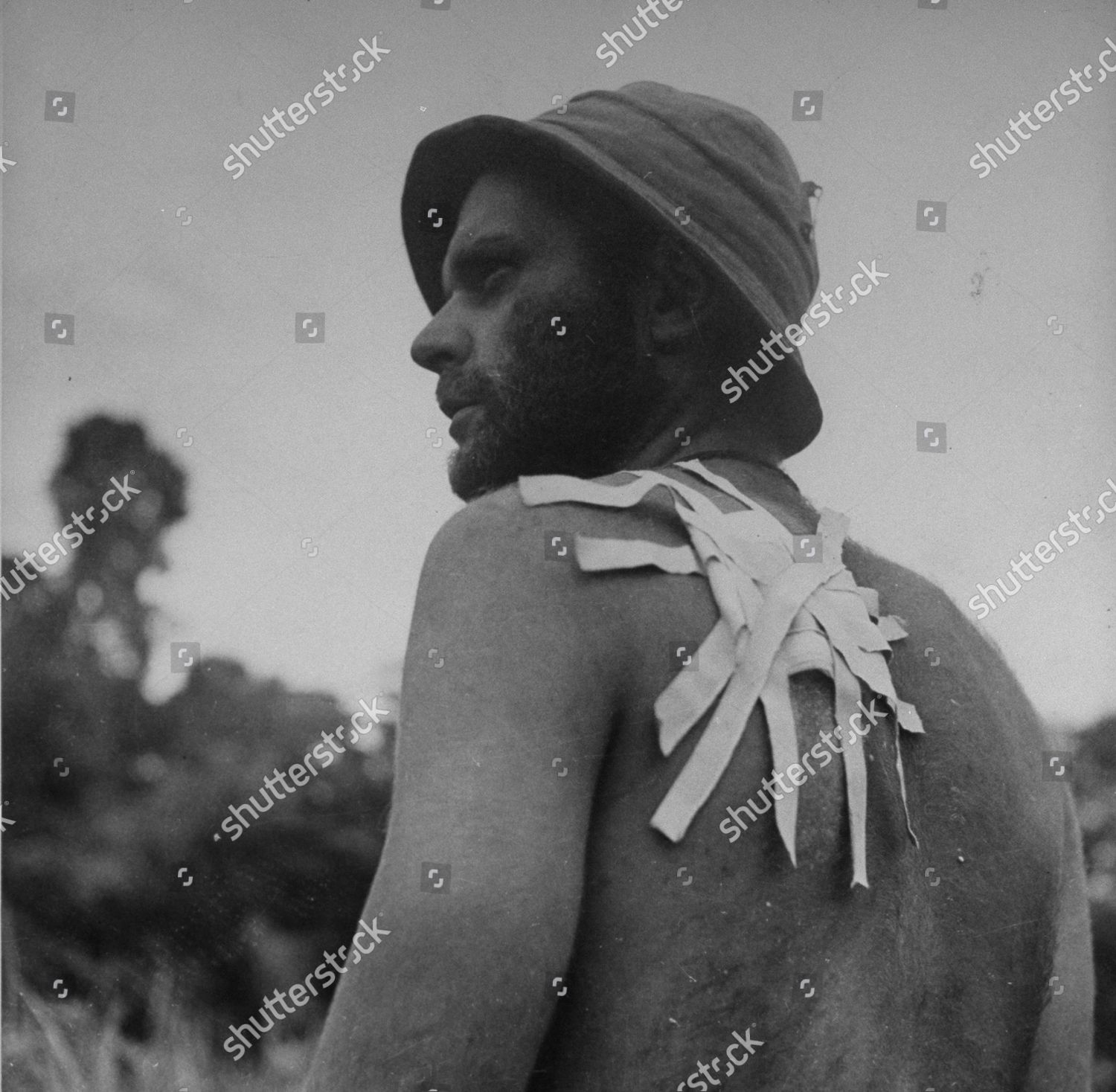 Bandaged American Soldier Wounded Fighting Against Editorial Stock ...