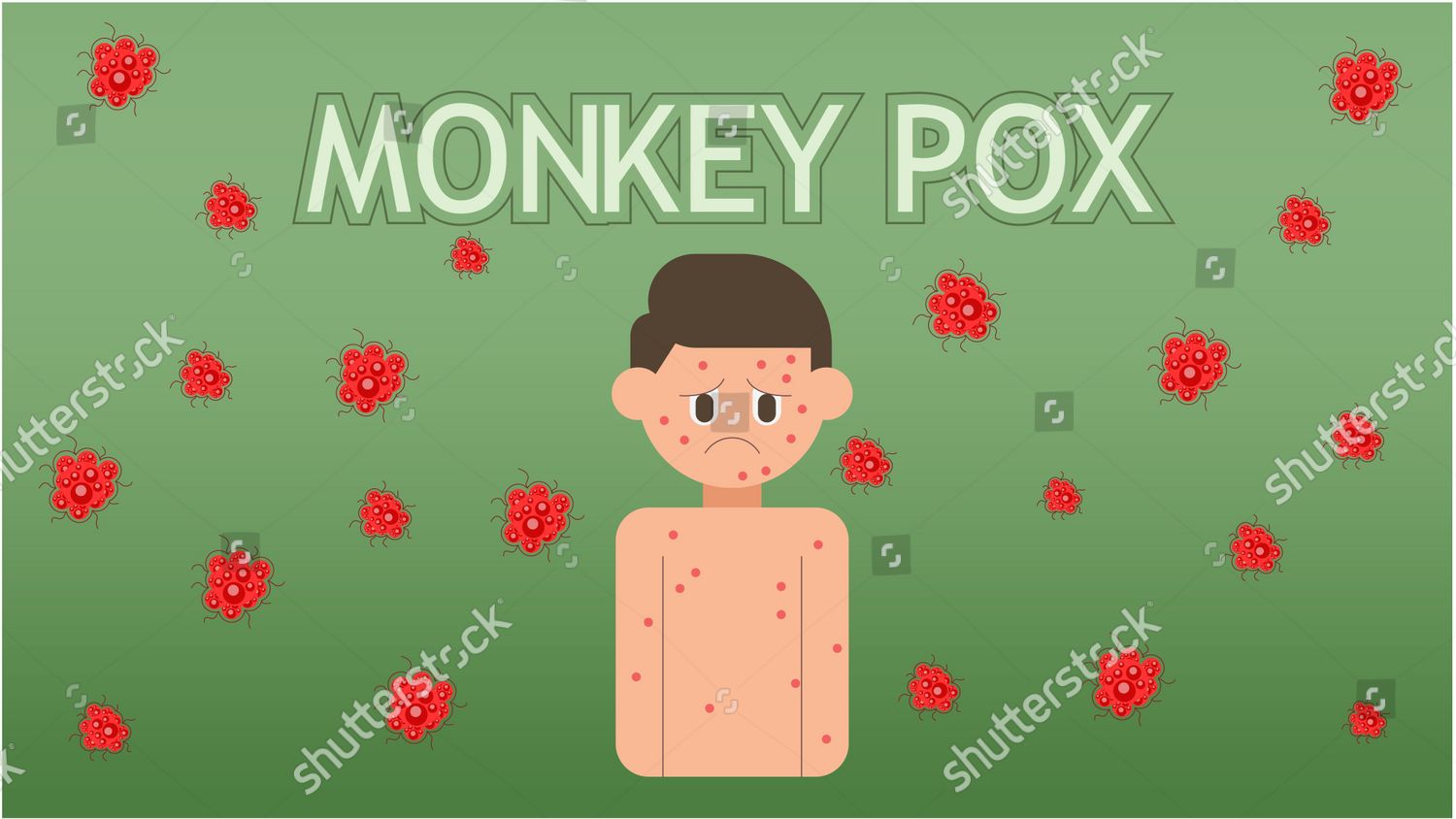 Monkeypox Concept Illustration Monkeypox Skin Urticaria Editorial Stock ...