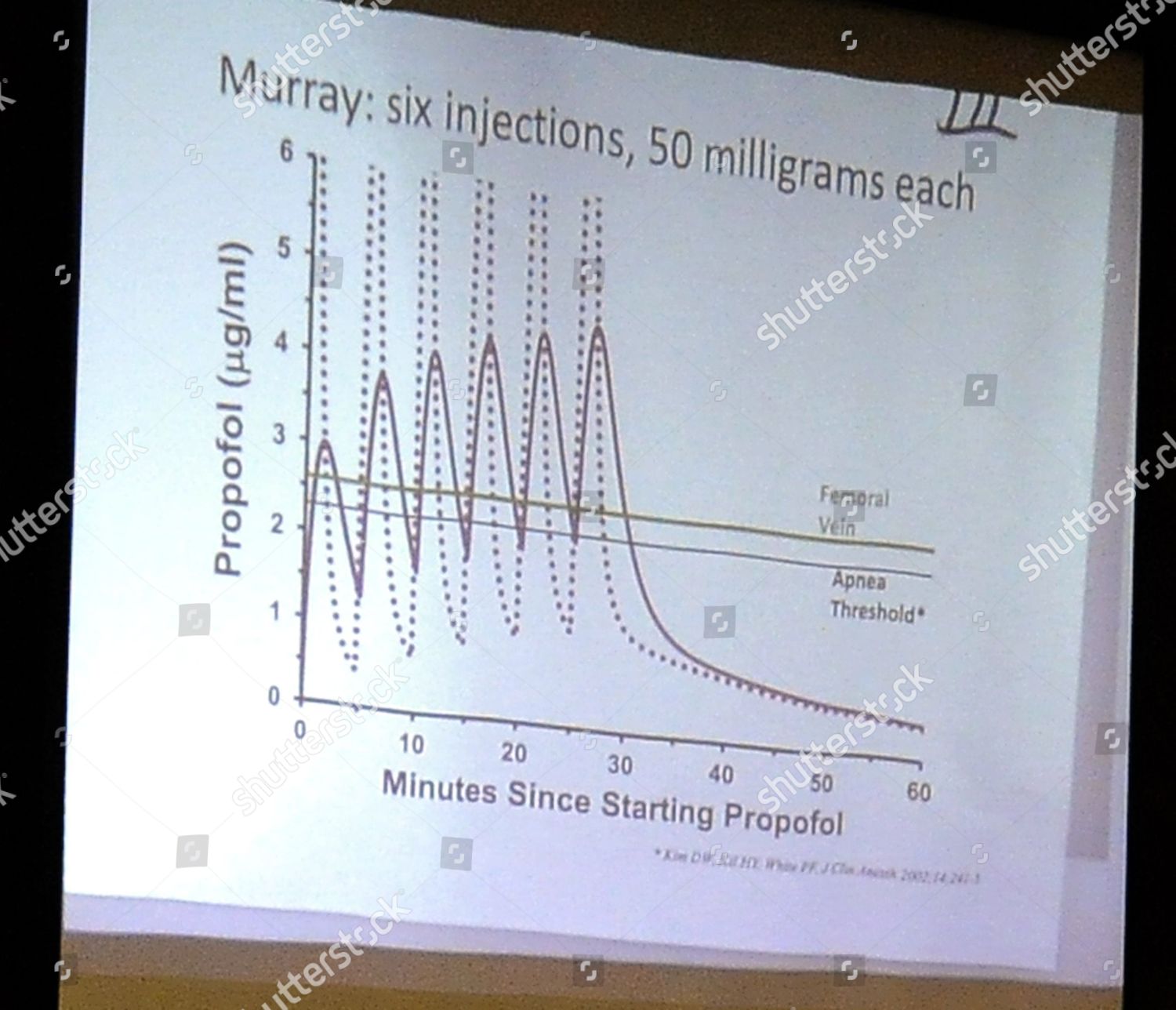 Slide Projection Chart Showing Propofol Injections Editorial Stock ...