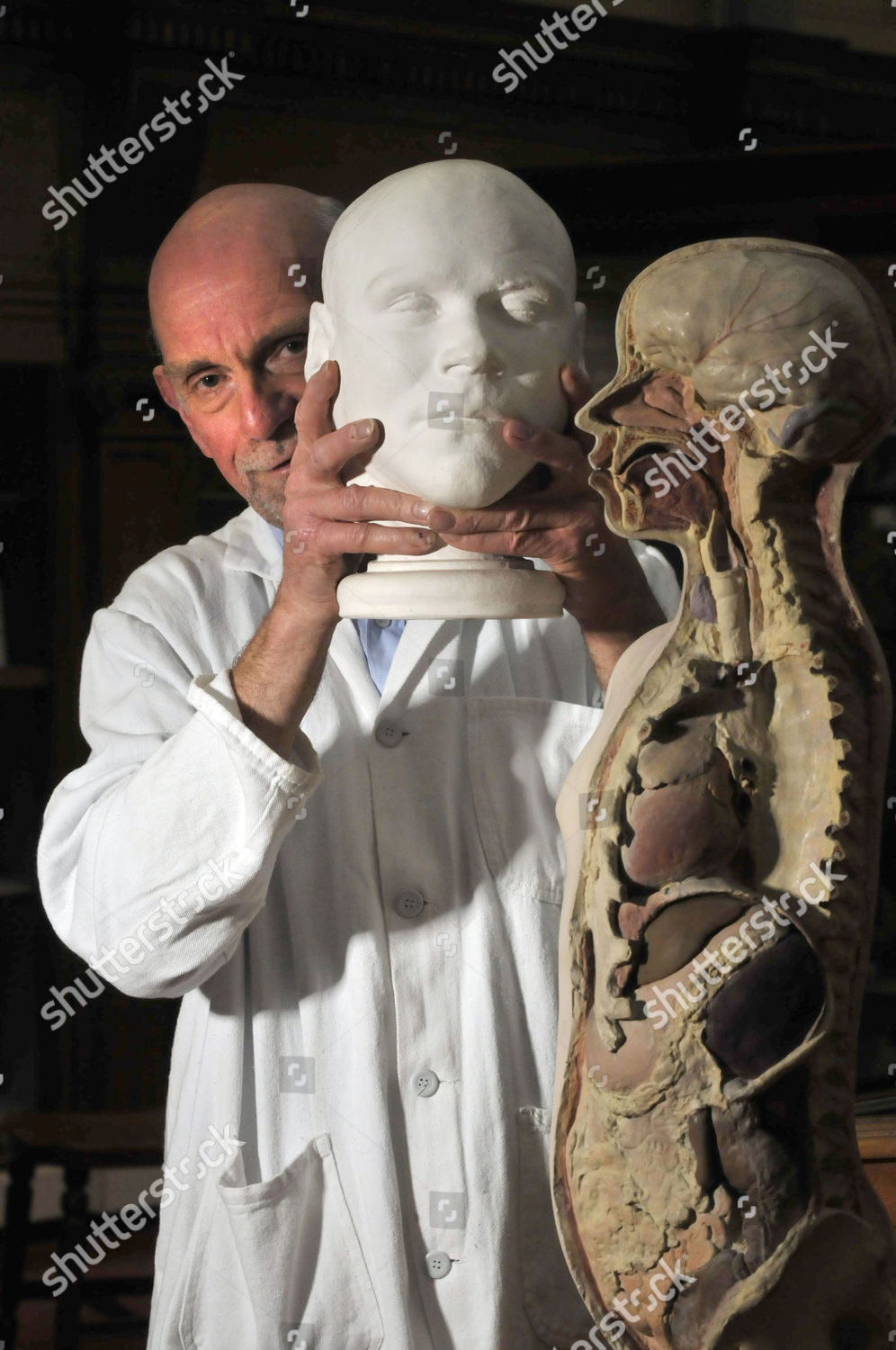 Gordon Findlater Head Anatomy Department Holds Editorial Stock Photo ...