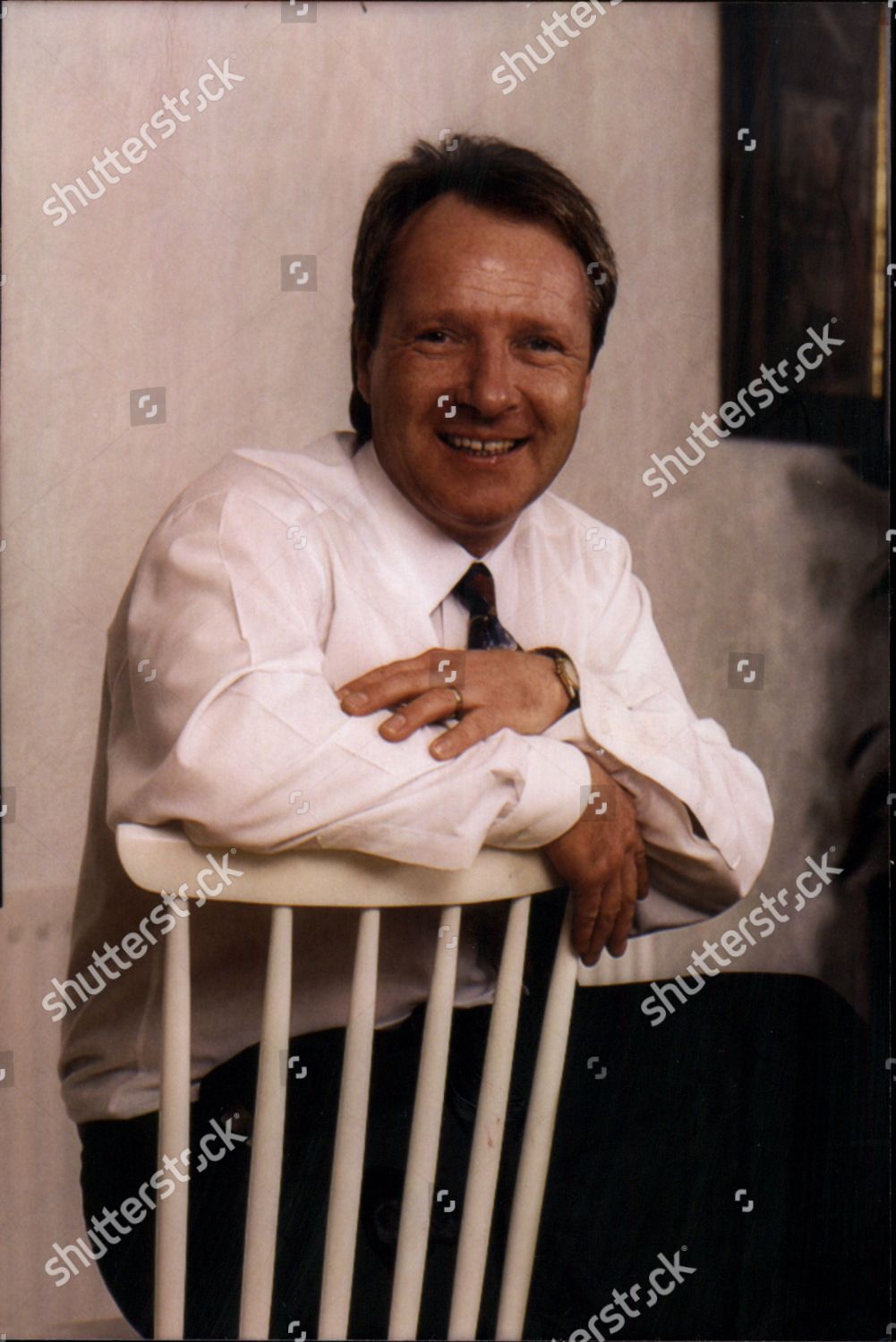 Nigel Deakin Who Has Had Blepharoplasty Editorial Stock Photo - Stock ...