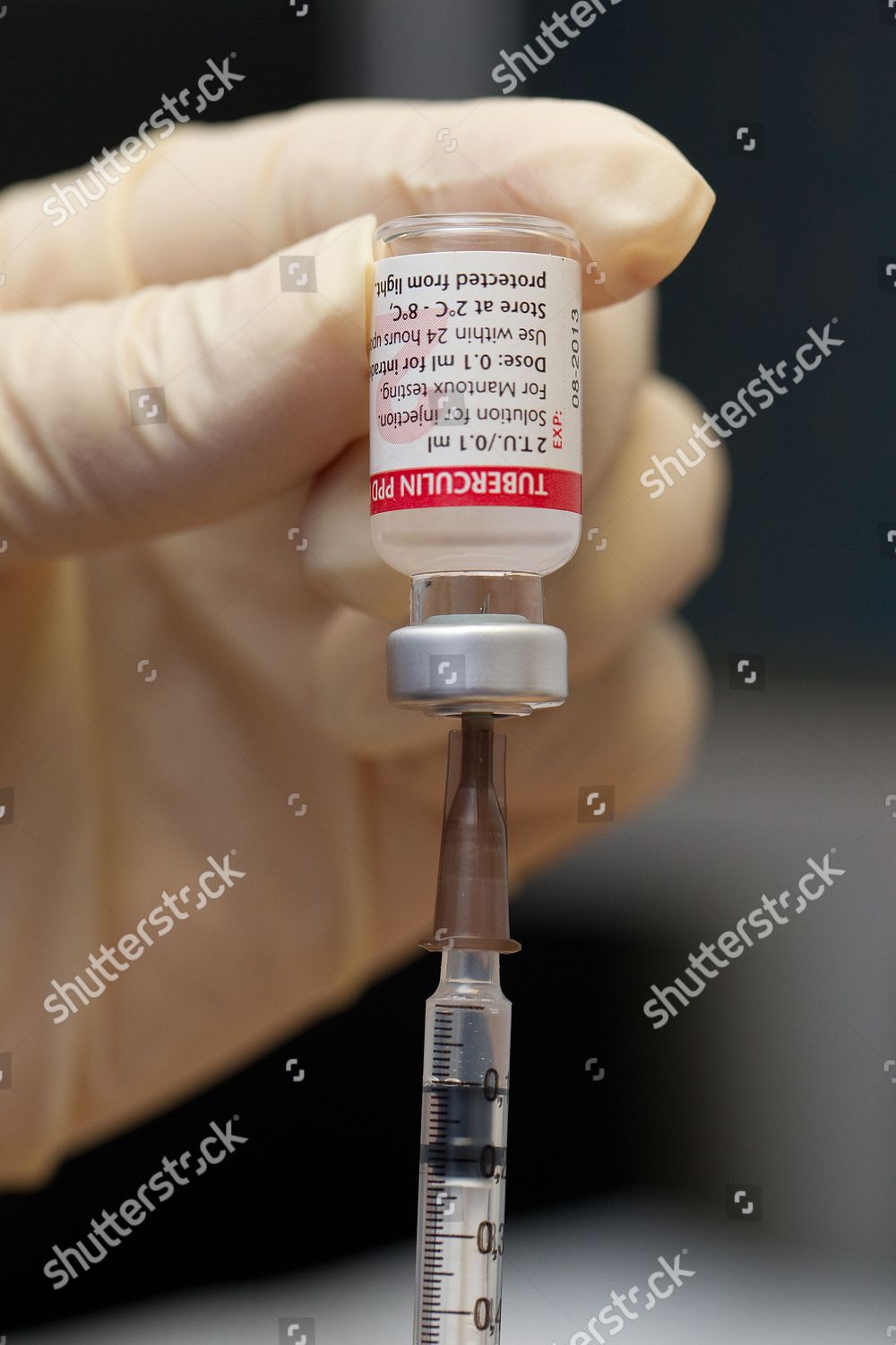Mantoux Test Signs Tuberculosis Editorial Stock Photo - Stock Image ...