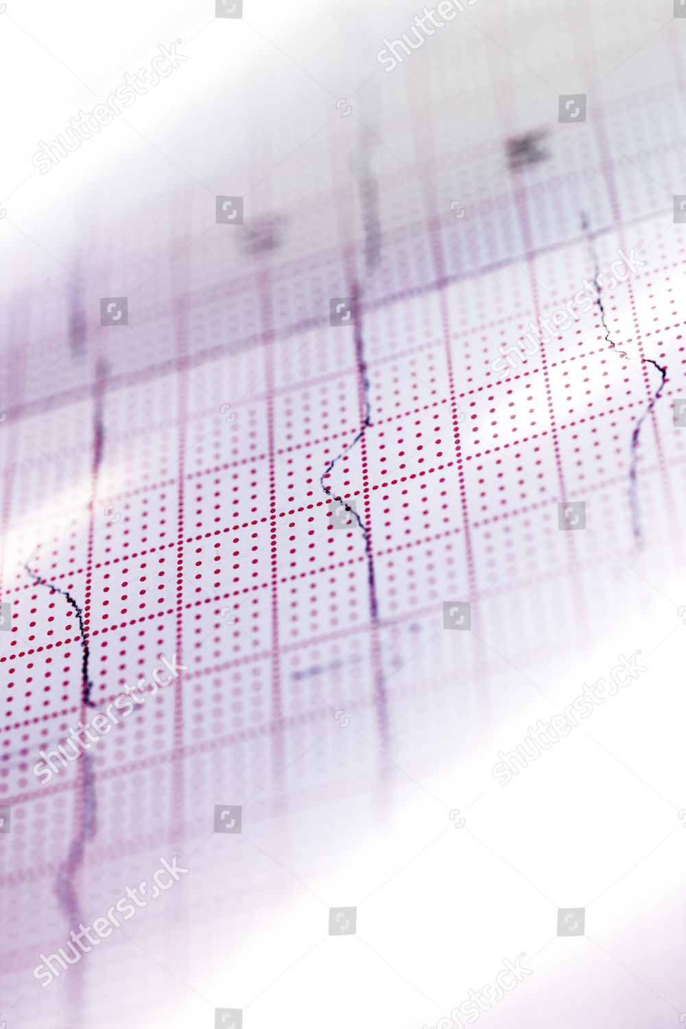 Electrocardiogram Ecg Ekg Editorial Stock Photo - Stock Image ...