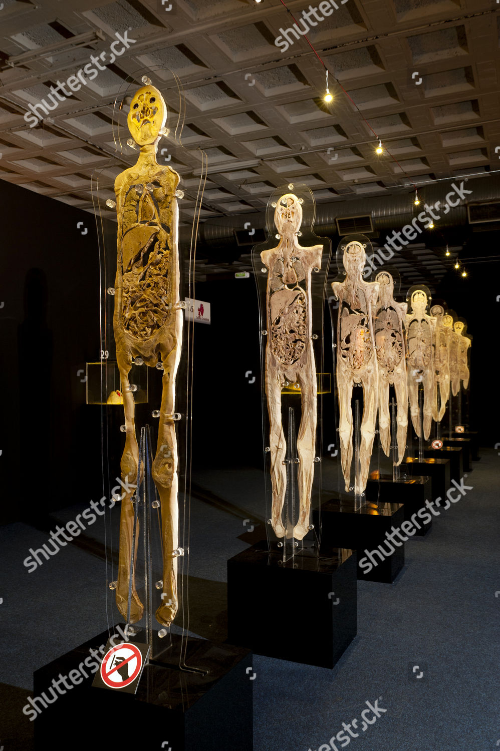Plastination Specimen Human Body Parallel Sections Editorial Stock ...