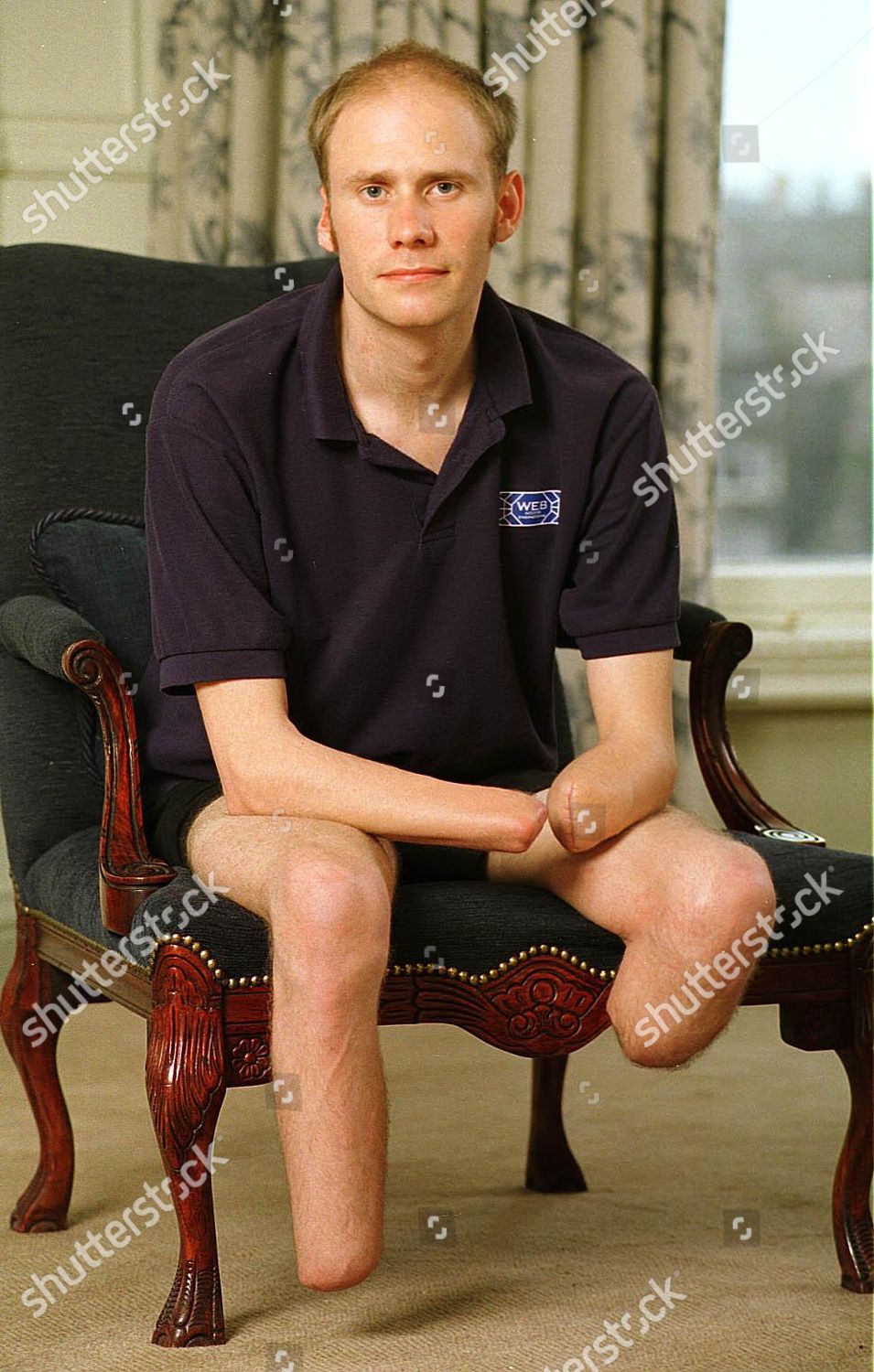 Jamie Andrew His Horrific Injuries Suffered Editorial Stock Photo ...